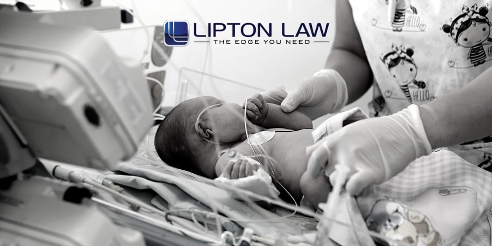Cephalohematoma Infant Birth Injury | Lipton Law | Birth Injuries