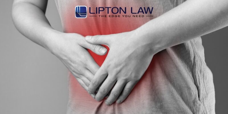 Michigan Perforated Bowel Lawsuit Attorney | Lipton Law