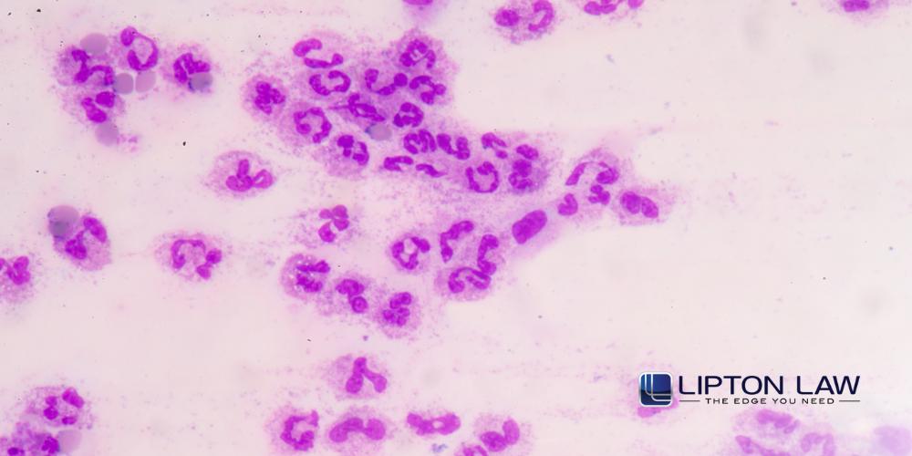 Bacteremia vs Sepsis: What’s the Difference? | Lipton Law